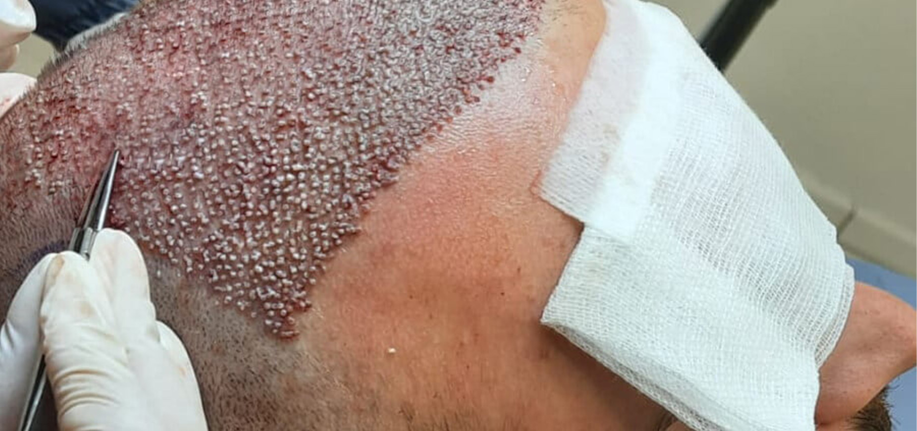 Mabel Hair Clinic – Mabel Hair Clinic