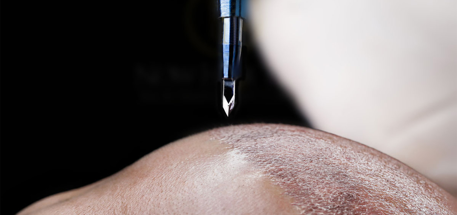 Mabel Hair Clinic – Mabel Hair Clinic